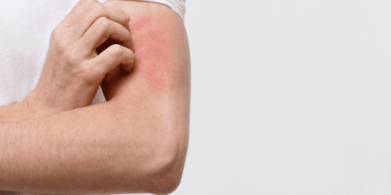 ISO 10993-23:2021 Biological evaluation of medical devices – Part 23 ...